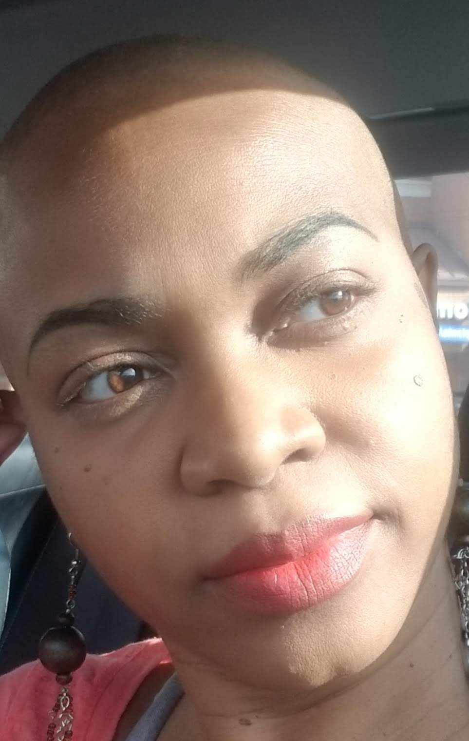 Financial toxicity in cancer care: One woman's story | Association of ...